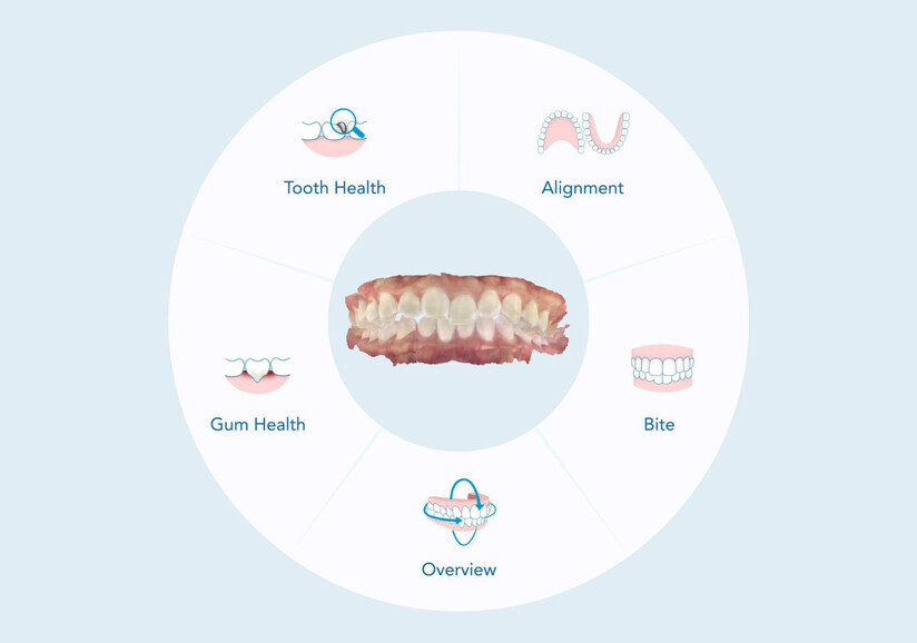 Align Technology—Align Oral Health Suite
