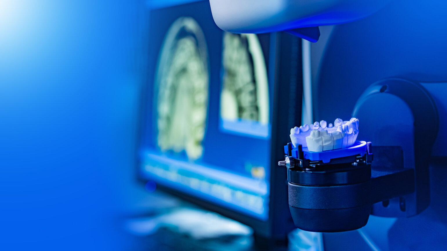 The influence of CAD software on crown morphology, function