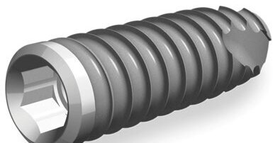 Ektos Implant System