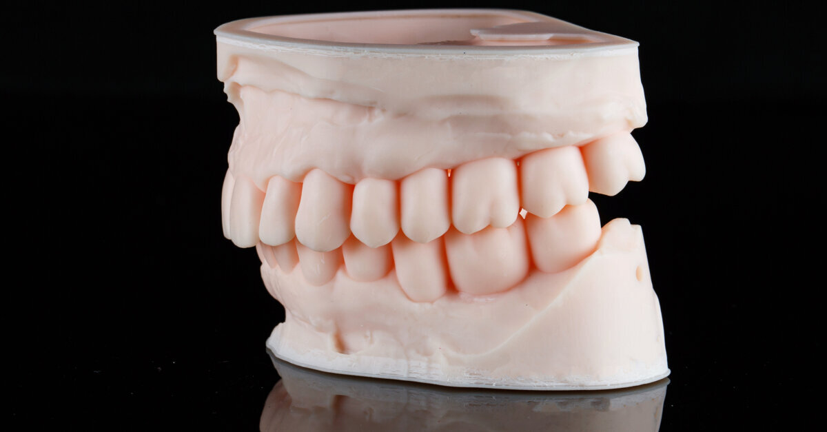 Direct 3D-printing of clear aligners by Align Technology