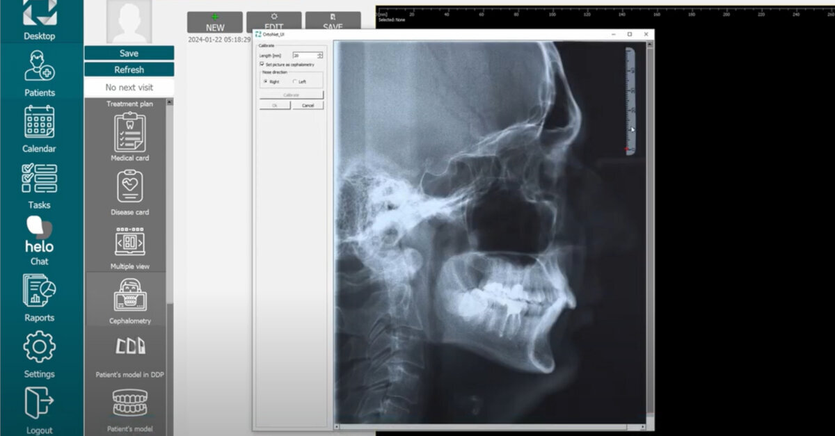 Polorto – Ortonet – Performing Cephalometry