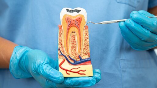 New expert consensus offers guide to apical microsurgery