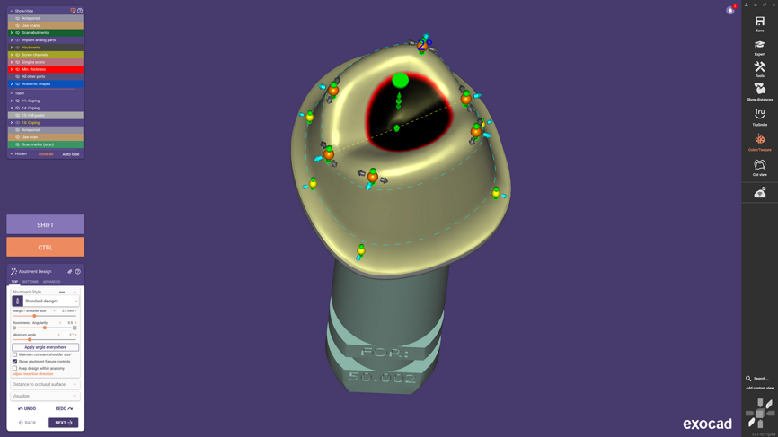 Exocad launches DentalCAD 3.3 Chemnitz - Dental News Network