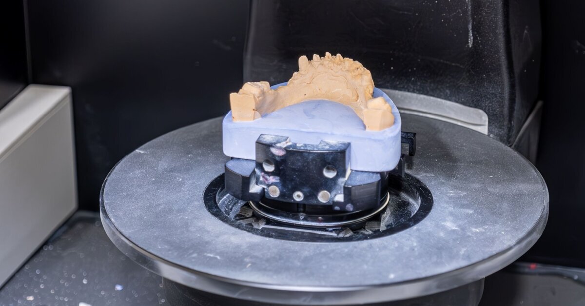 3D-printed shell complete dentures for implant planning