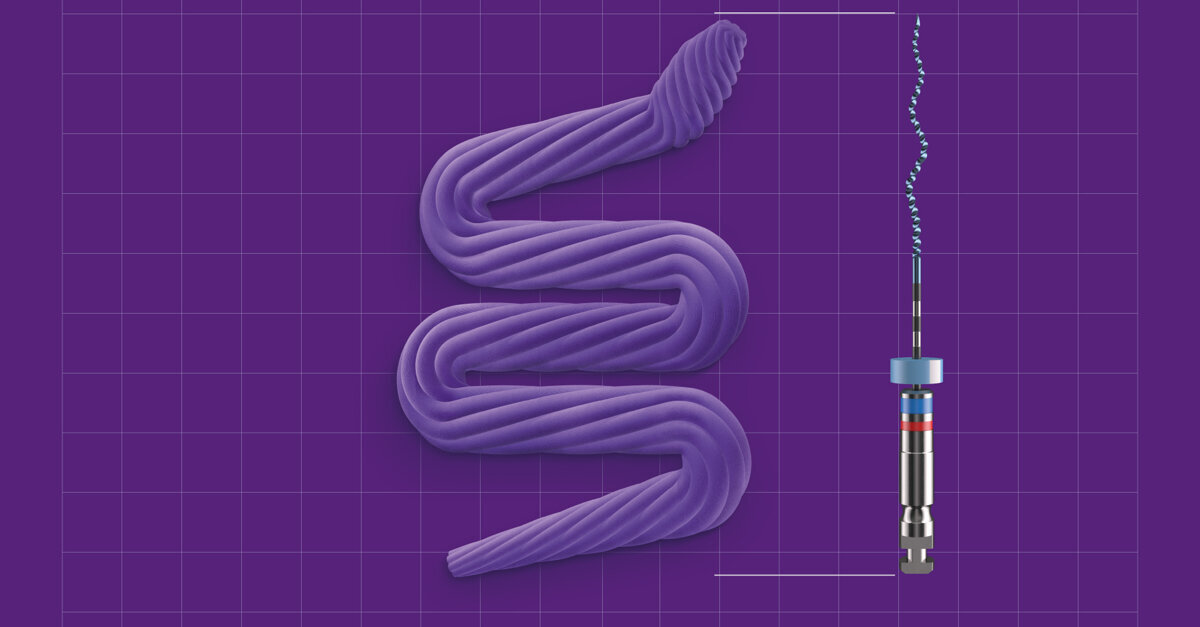 FKG Dentaire – XP-endo Rise