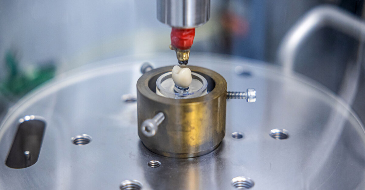 Dental News - New dentine-like material may replace extracted teeth for ...