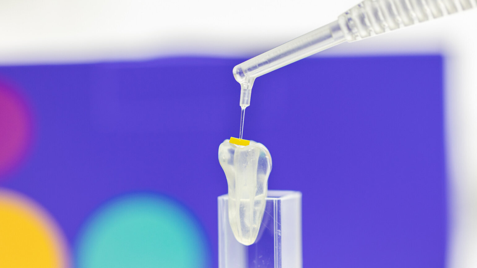 Odne receives clearance for endodontic debridement device