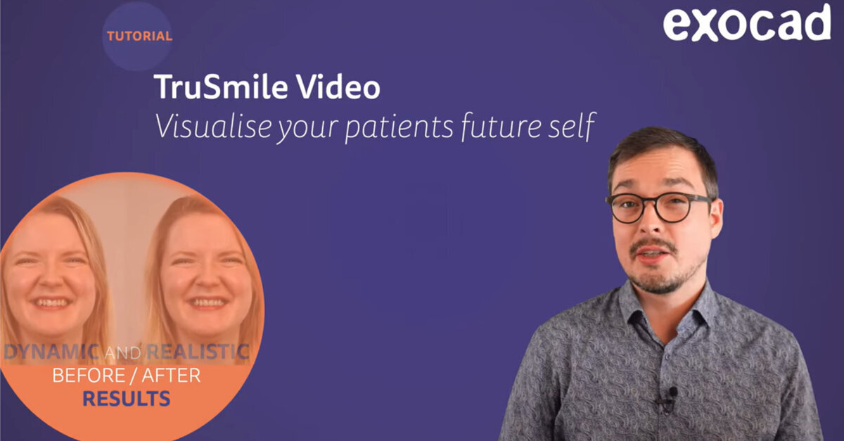 exocad – TruSmile Video – Realistic Makeover Visualizations for Smile ...