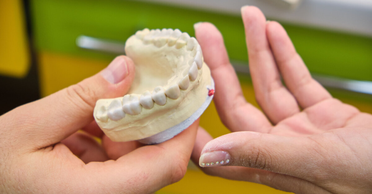 Dental News - 3D-printed denture teeth suitable for long-term clinical use