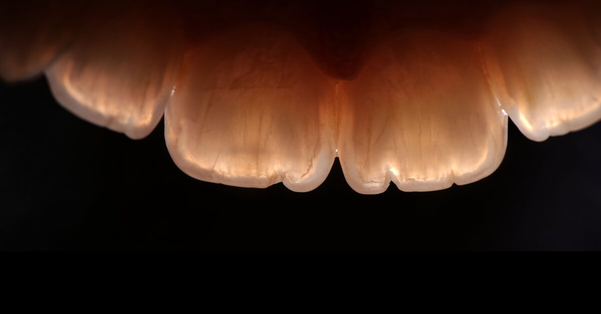 Biomimetic restorative dentistry with Dr Pascal Magne