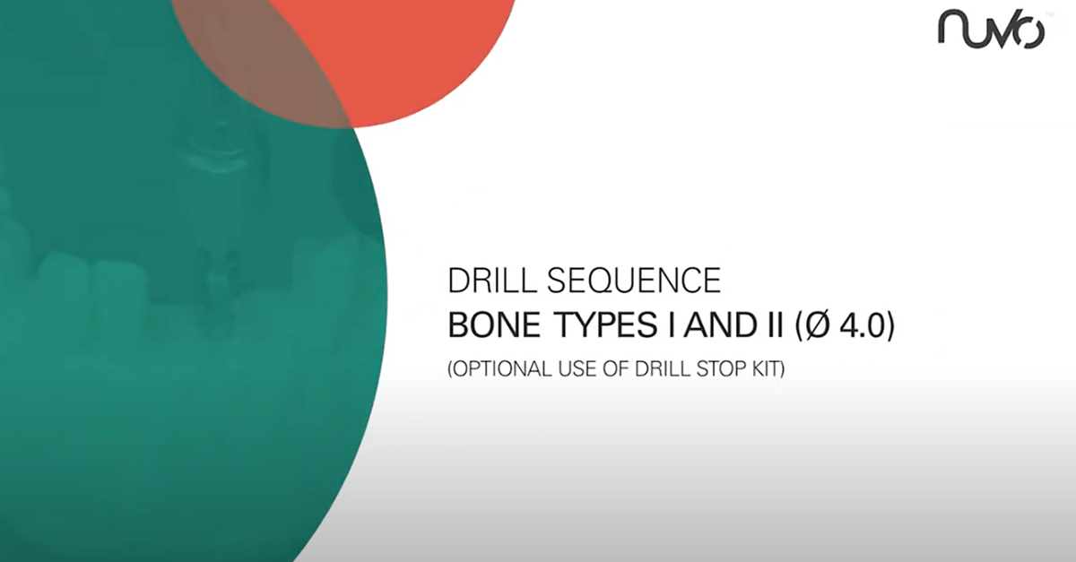 ConicalFIT Drill Sequence Bone Types I&II