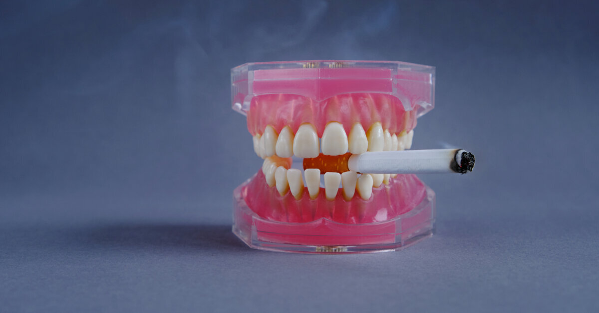 Smoking and peri-implant disease