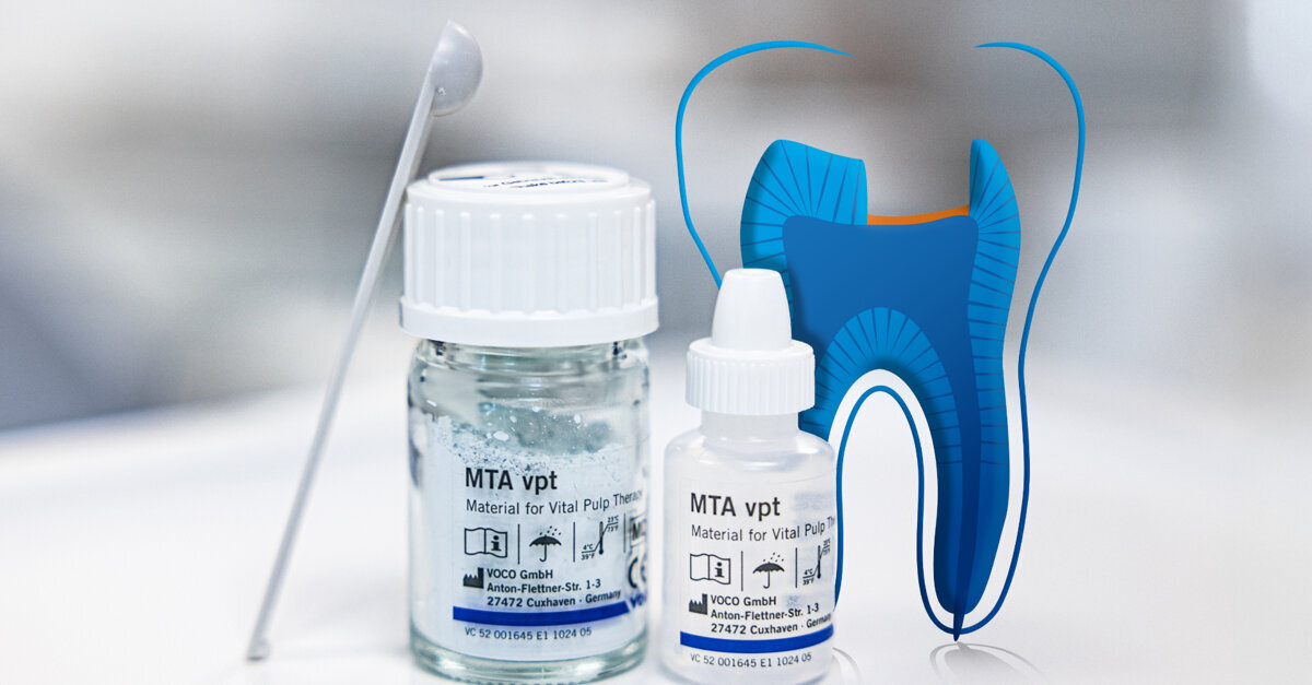 VOCO – MTA vpt