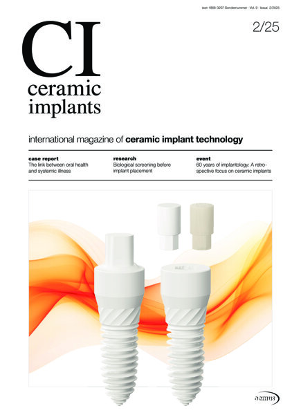ceramic implants international No. 2, 2025 - Dental Tribune E-Paper