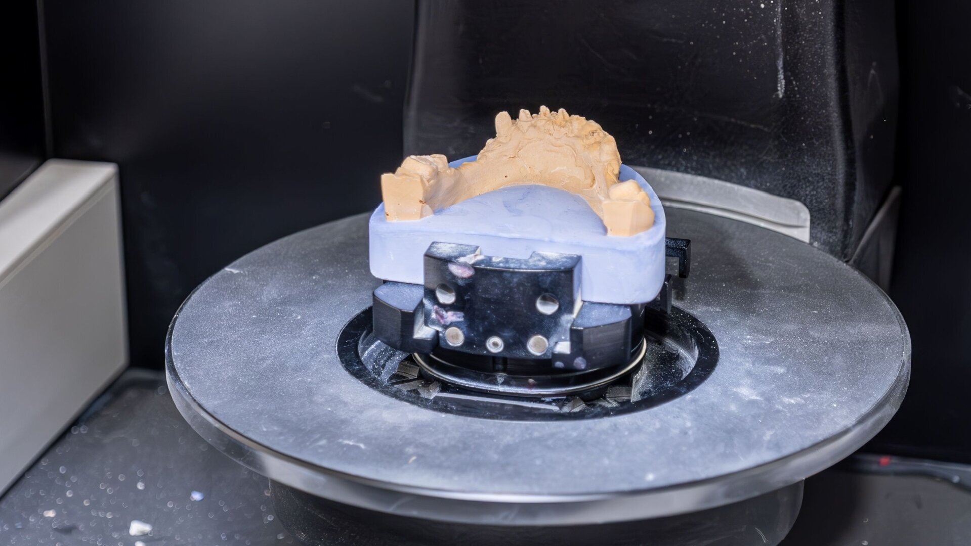 3D-printed shell complete dentures for implant planning