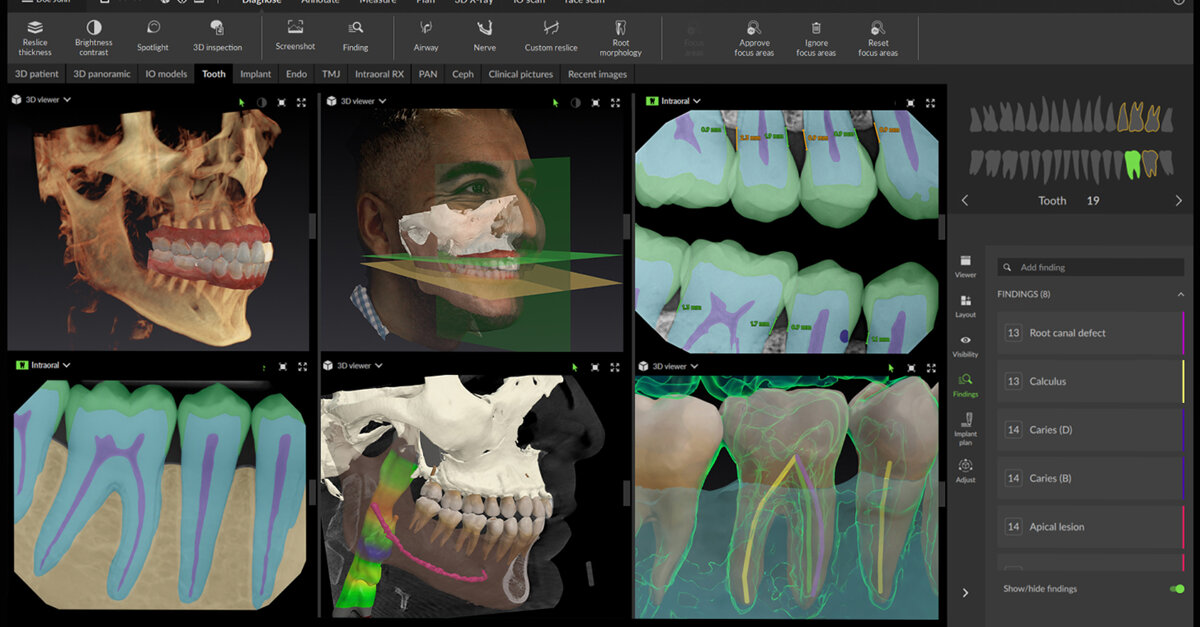 Dental News - DEXIS sets a new benchmark for digital dentistry with ...