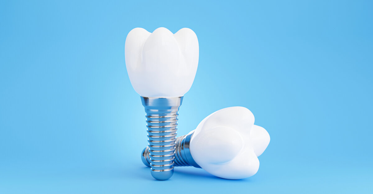 DT News - Vietnam - Các nhà nghiên cứu phát triển implant nha khoa cá ...