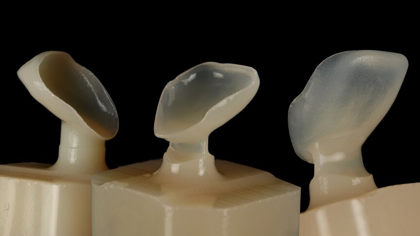 New world record: German dentist extracts world’s longest human tooth