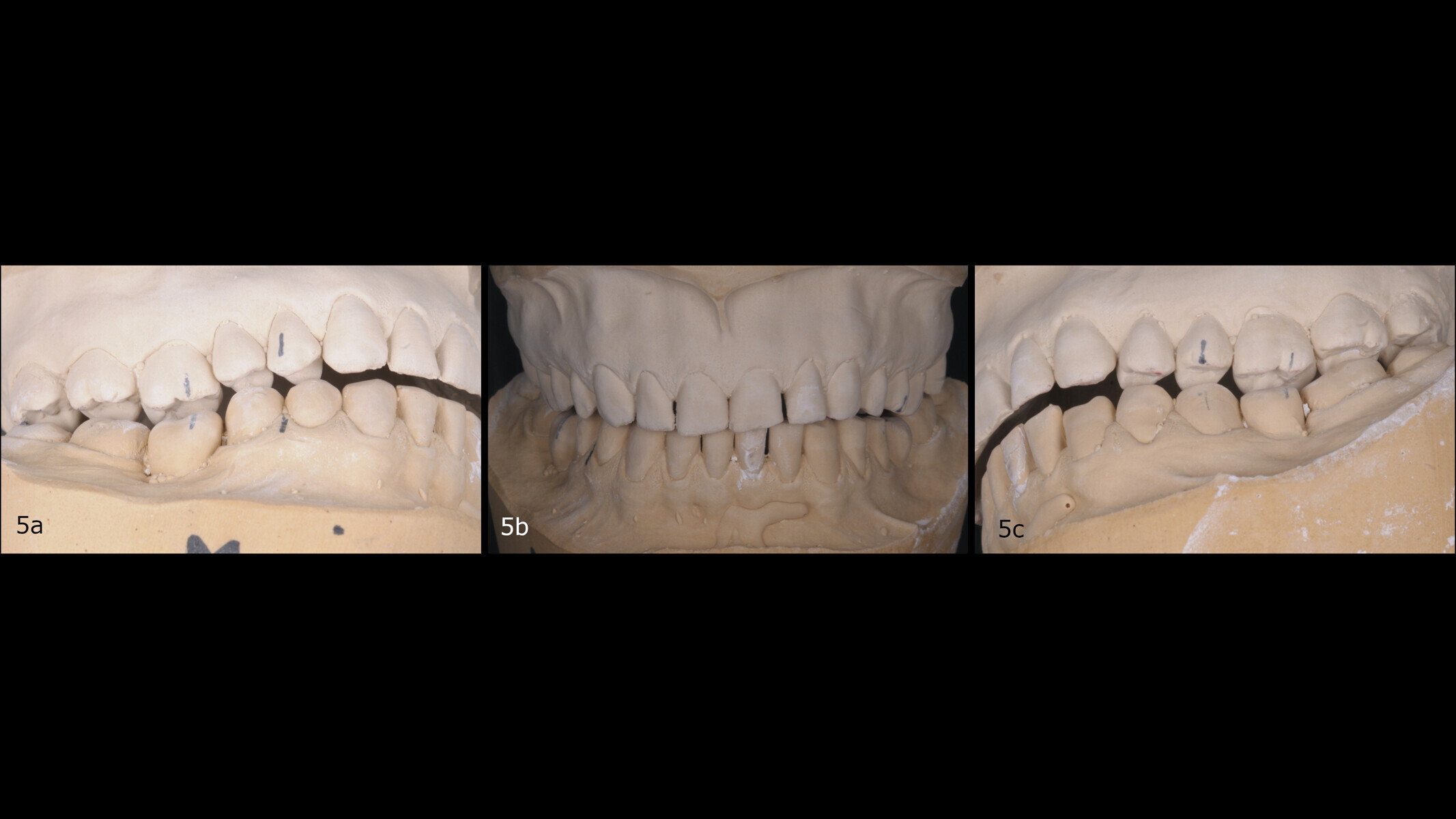 Case report