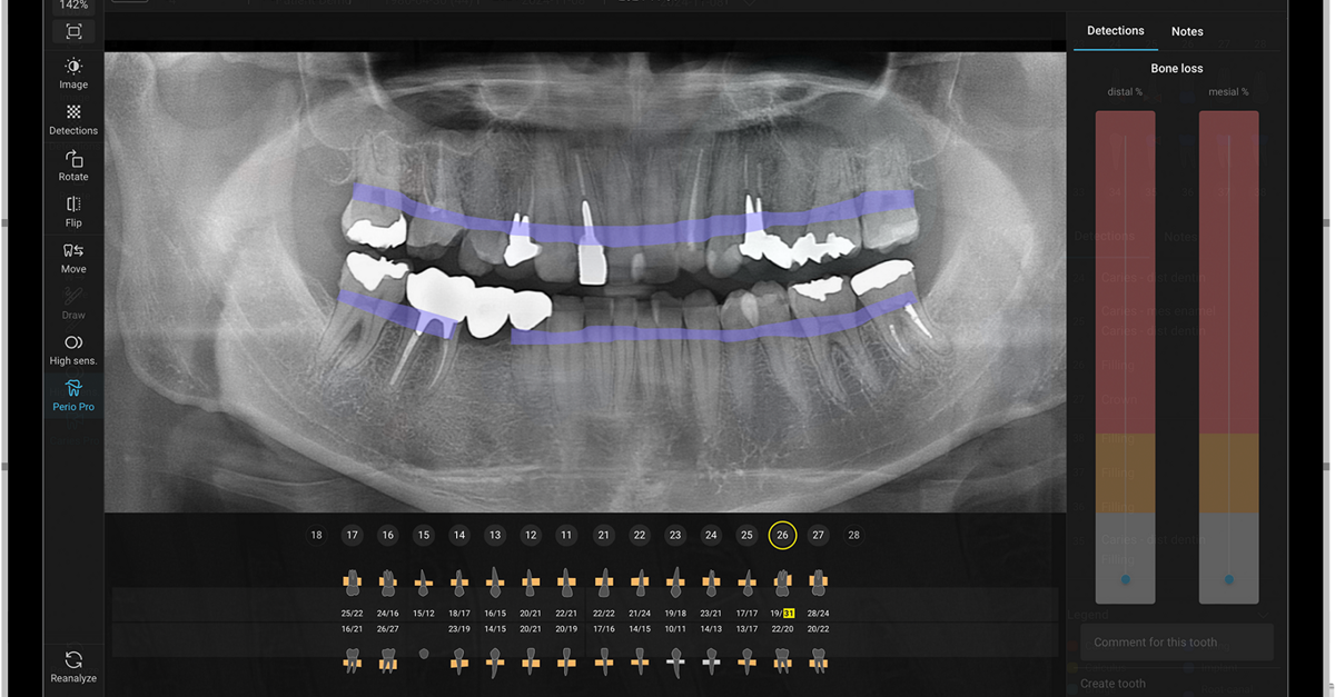 Align X-ray Insights