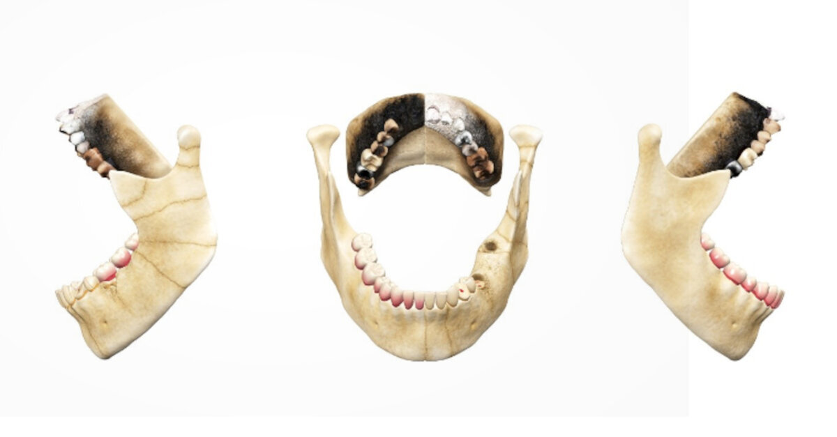 Interview with Dr Scheila Manica about forensic odontology