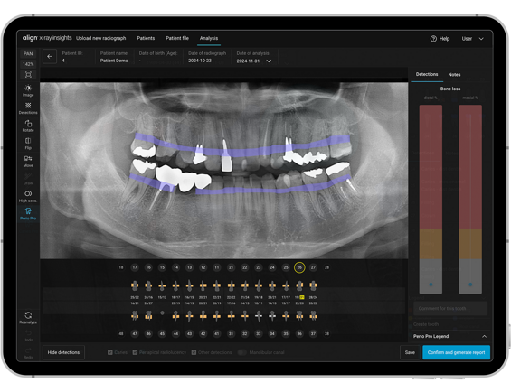 Align X-ray Insights