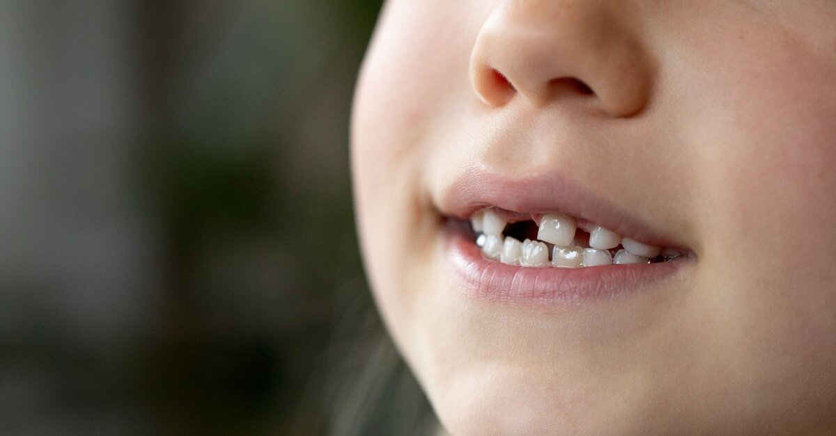 DT News - India - Deciduous teeth enamel as a biological archive of ...