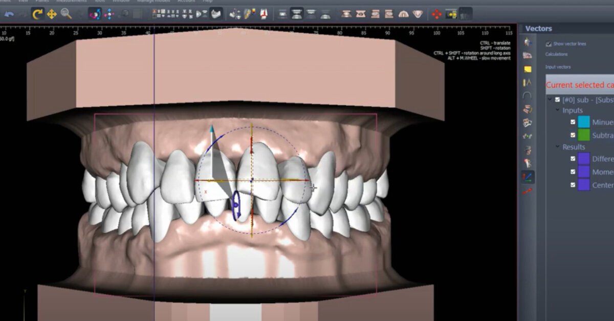 Polorto – DDP-Ortho – 3D Biomechanics Planner by Giorgio Fiorelli