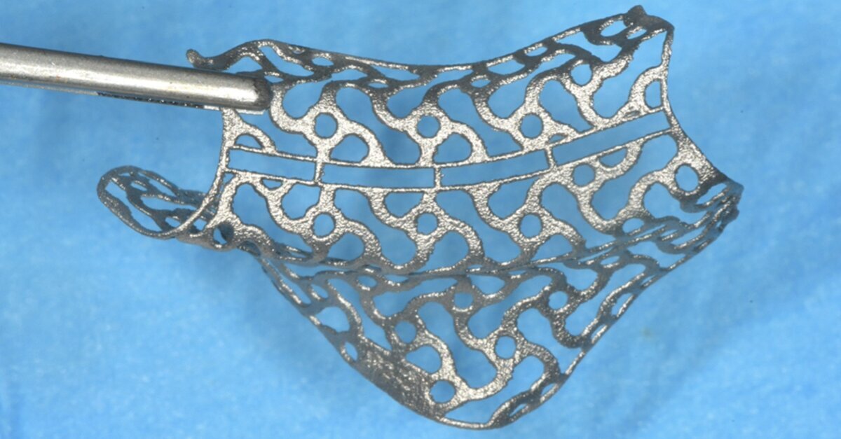 Vertical ridge augmentation