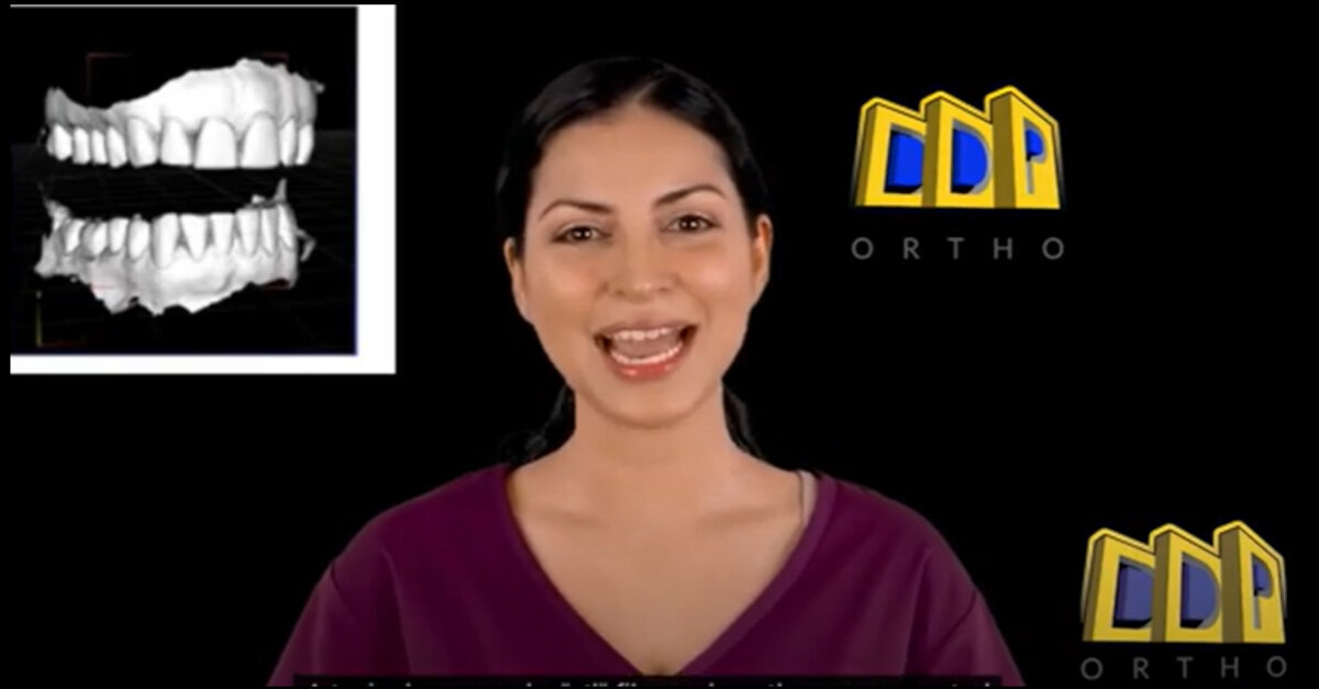 Polorto – DDP-Ortho – Diagnostic Models and their Differences to Scans